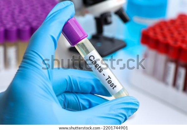 Urine Samples Testing Casts Laboratory Urine Stock Photo 2201744901 ...