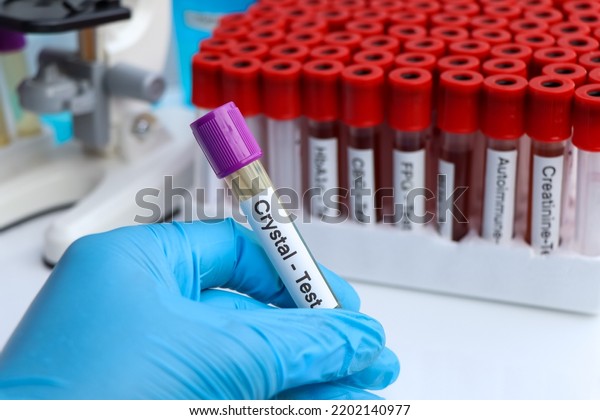 Urine Samples Testing Crystal Laboratory Urine Stock Photo 2202140977 ...