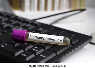 Urine Samples Testing Methamphetamine Laboratory Urine Stock Photo ...