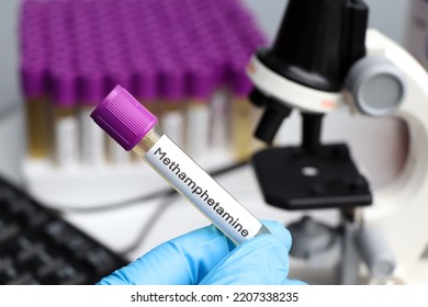 Urine Samples Testing Methamphetamine Laboratory Urine Stock Photo ...