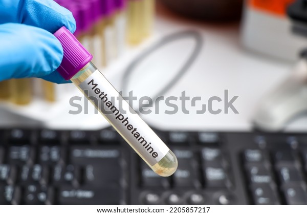 Urine Samples Testing Methamphetamine Laboratory Urine Stock Photo ...