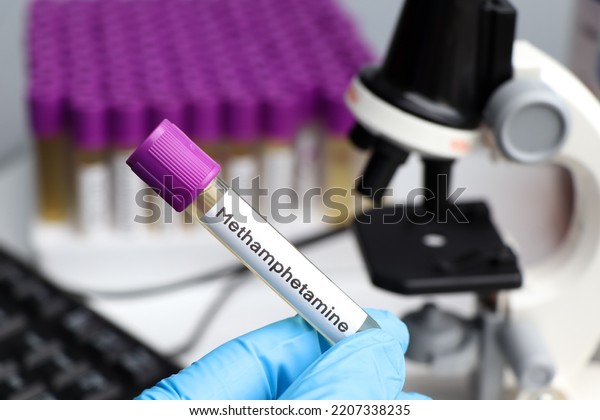 Urine Samples Testing Methamphetamine Laboratory Urine Stock Photo ...