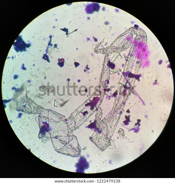 Using Light Microscope Observed That Name Stock Photo 1222479238 ...