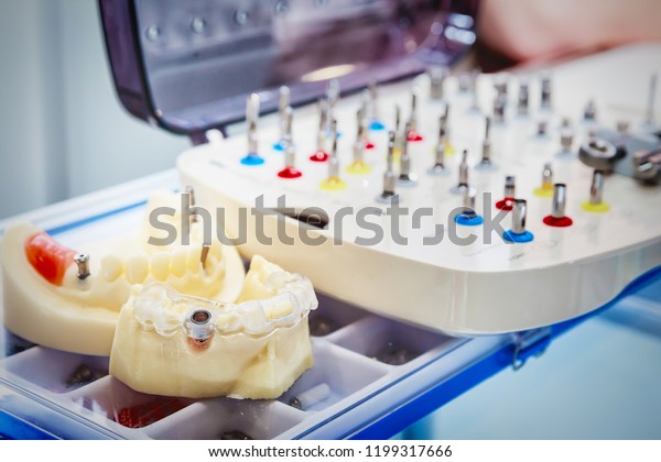 Various Samples Casts Dentures Tools Their Stock Photo 1199317666 ...