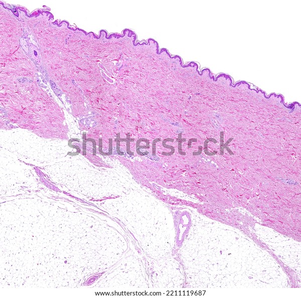 Very Low Power Light Microscope Micrograph Stock Photo 2211119687 ...