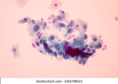 Normal Endocervical Cells Squamous Epithelial Cells库存照片1055140088 ...