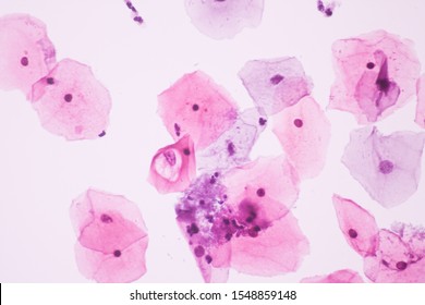 View Microscopic Normal Human Cervix Cellssquamous Stock Photo (Edit ...