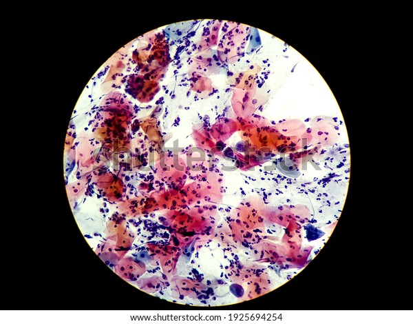 View Microscopic Cervical Human Cells Smear Stock Photo 1925694254 ...
