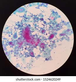 View Microscopic Herpes Simplex Virus Ground Stock Photo 1524620249 ...