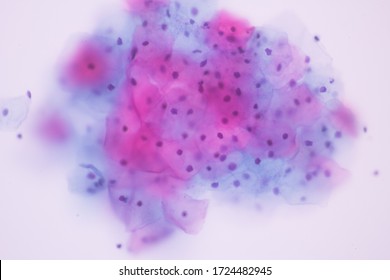 View Microscopic Normal Human Cervical Cellssquamous Stock Photo ...