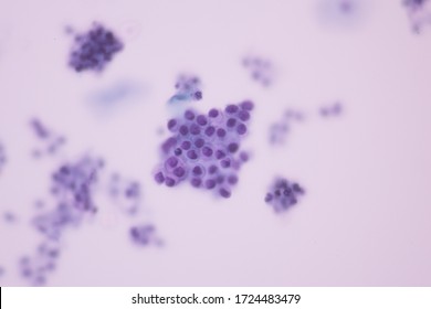1,136 imágenes de Citología cervical - Imágenes, fotos y vectores de ...