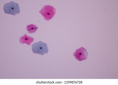 View Microscopic Normal Human Cervix Cellssquamous Stock Photo (Edit ...