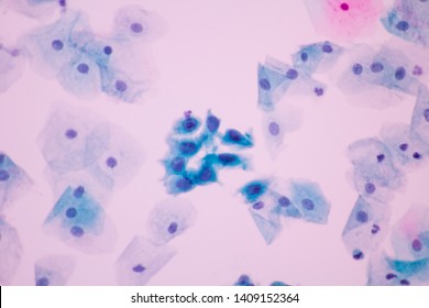 View Microscopic Normal Human Cervix Cells Stock Photo 1409152364 ...