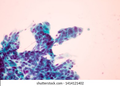 View Microscopic Normal Human Cervix Cells Stock Photo 1414121402 ...
