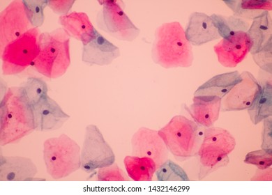 View Microscopic Normal Human Cervix Cellssquamous Stock Photo (Edit ...