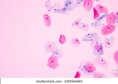 View Microscopic Normal Human Cervix Cellssquamous Foto de stock ...
