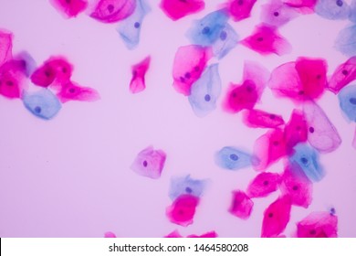 View Microscopic Normal Human Cervix Cellssquamous Stock Photo ...