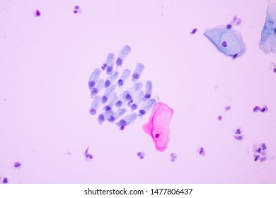 View Microscopic Normal Human Cervix Cellsglandular Stock Photo (Edit ...