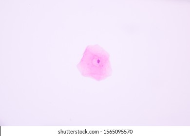 View Microscopic Normal Human Cervix Cellssquamous Stock Photo ...