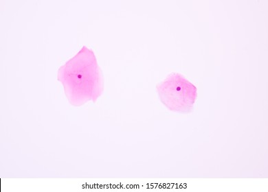 View Microscopic Normal Human Cervix Cellssquamous Stock Photo ...
