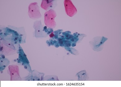 View Microscopic Normal Human Cervix Cellssquamous Stock Photo ...