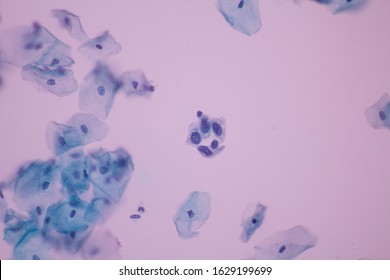 View Microscopic Normal Human Cervix Cellssquamous Stock Photo ...
