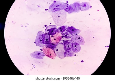 View Microscopic Normal Human Cervix Cellssquamous Stock Photo ...