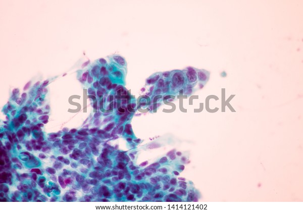 View Microscopic Normal Human Cervix Cells Stock Photo 1414121402 ...