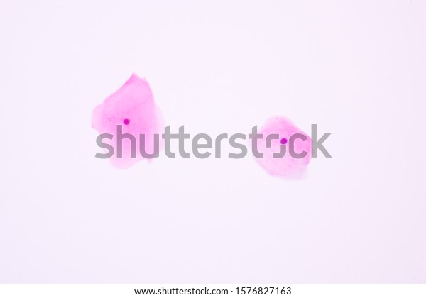 View Microscopic Normal Human Cervix Cellssquamous Stock Photo ...