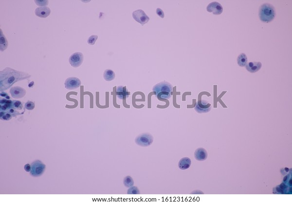 View Microscopic Normal Human Cervix Cellssquamous Stock Photo ...