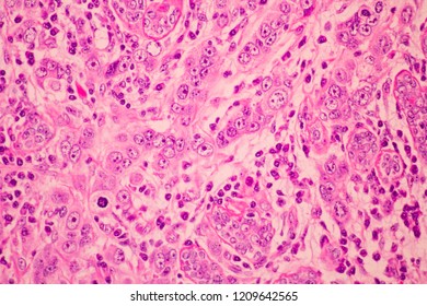 View Microscopic Pathology Cross Section Tissue Stock Photo 1209642565 ...