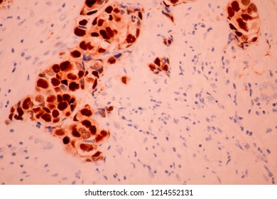 View Microscopic Pathology Cross Section Tissue Stock Photo (Edit Now ...
