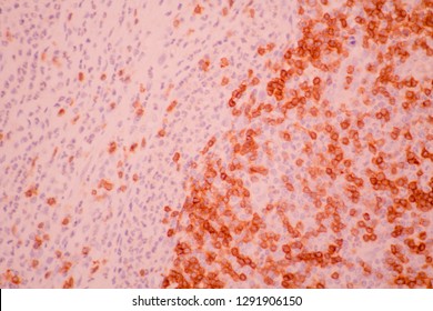 View Microscopic Pathology Cross Section Tissue Stock Photo 1291906150 ...