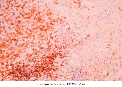 View Microscopic Pathology Cross Section Tissue Stock Photo (Edit Now ...