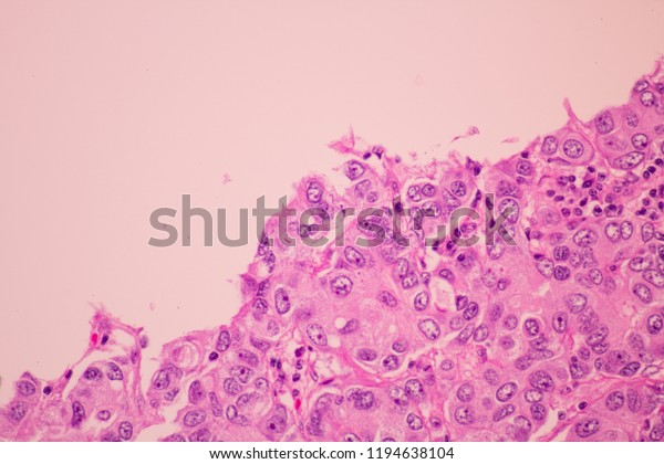 View Microscopic Pathology Cross Section Tissue Stock Photo (Edit Now ...
