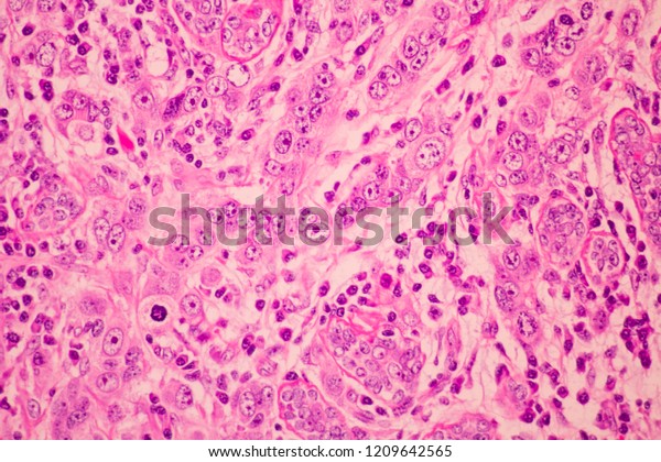 View Microscopic Pathology Cross Section Tissue Stock Photo 1209642565 ...
