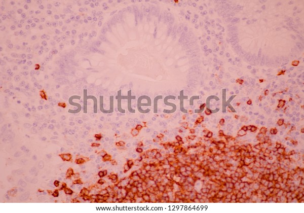 View Microscopic Pathology Cross Section Tissue Stock Photo 1297864699 ...