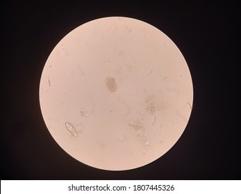 577 Hookworm microscope Images, Stock Photos & Vectors | Shutterstock