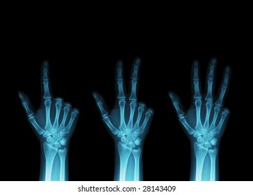 507 X Ray Number Images, Stock Photos & Vectors | Shutterstock
