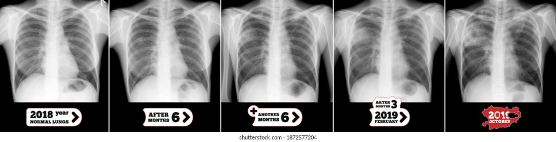 267 Bullet x ray Images, Stock Photos & Vectors | Shutterstock