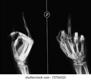 507 X Ray Number Images, Stock Photos & Vectors | Shutterstock