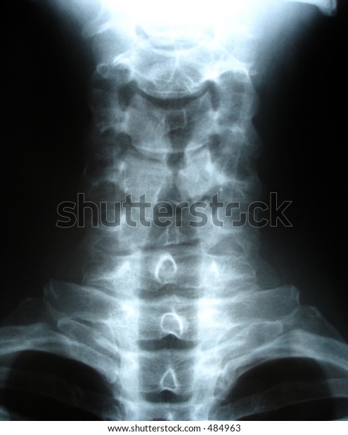 Xray Neck Stock Photo (Edit Now) 484963