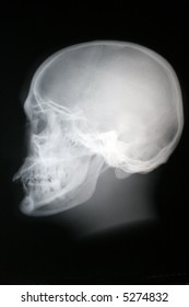 Xray Phantom Head Face Stock Photo 5274832 | Shutterstock