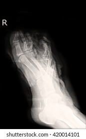 X Ray Thorax Abdomen Female Cat Stock Photo (Edit Now) 1862494033