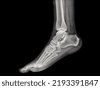 18,087 Xray Hand Royalty-Free Images, Stock Photos & Pictures ...