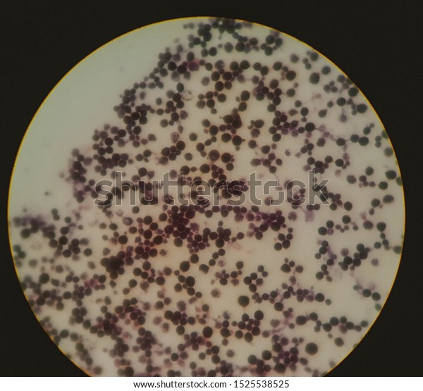 Yeast Budding Yeast Cells Cgaracteristcis Cryptococcal Stock Photo ...