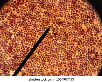 Yeast Budding Yeast Cryptococcus Neoformans Staining Foto stock ...