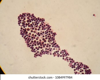 Cryptococcus neoformans 144 รายการ ภาพ ภาพสต็อกและเวกเตอร์ | Shutterstock
