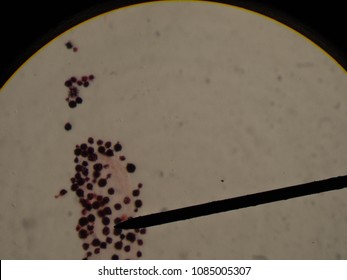 Yeast Budding Yeast Cryptococcus Neoformans Staining Stock Photo ...