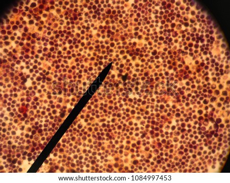 Yeast Budding Yeast Cryptococcus Neoformans Staining Stock Photo (Edit ...